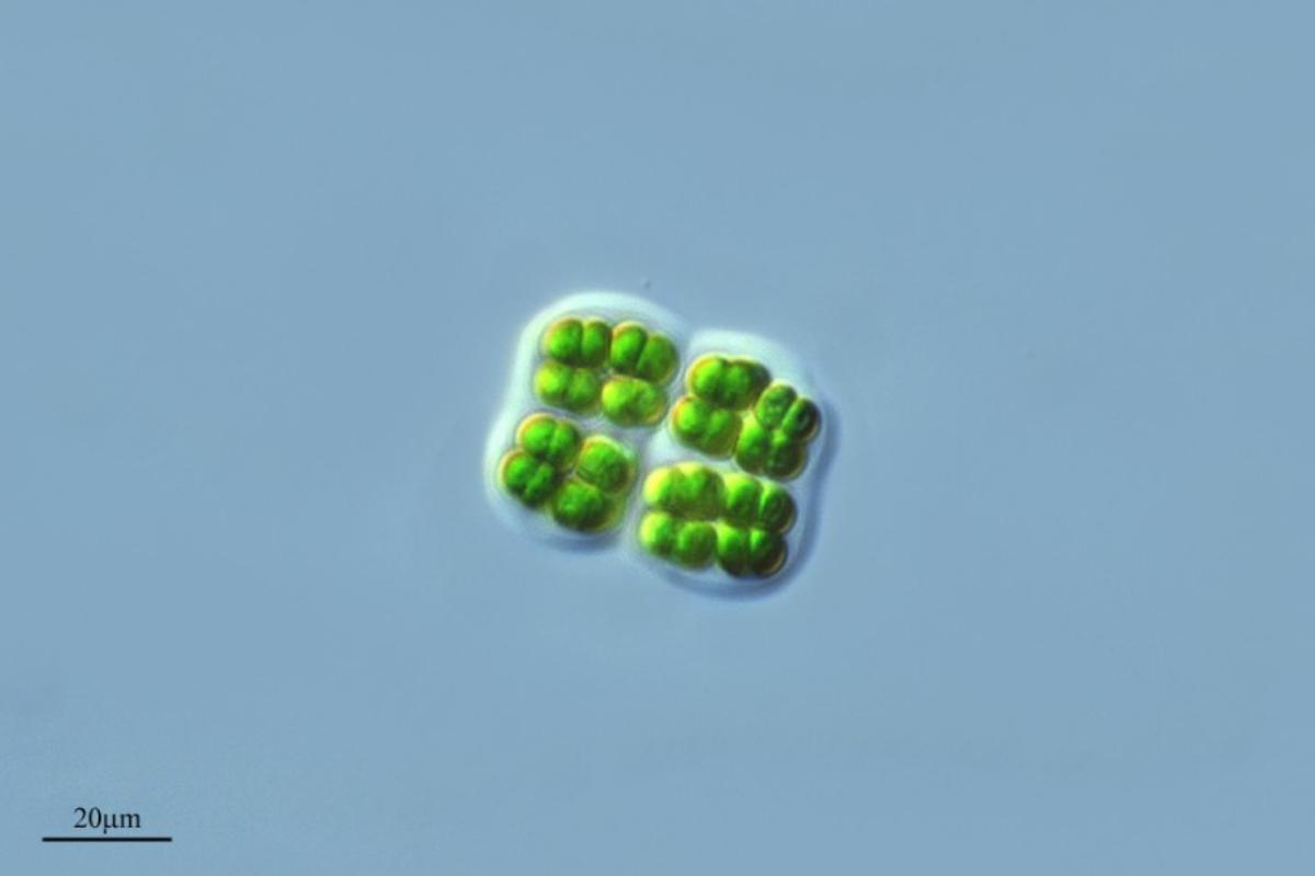What Are Cyanobacteria in Biology? - Definition With Characteristics ...